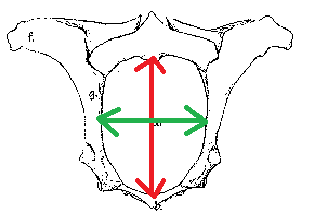 How to Deliver an Oversized Calf - Vet in Training