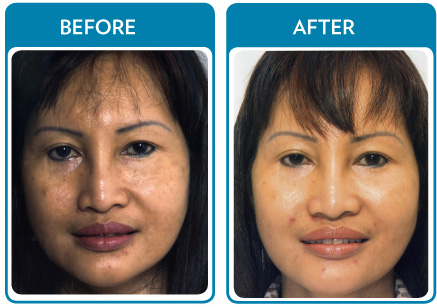 ageLOC Transformation