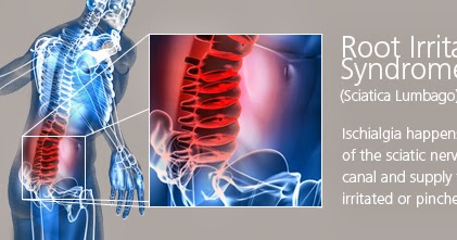 LAPORAN PENDAHULUAN ISCHIALGIA