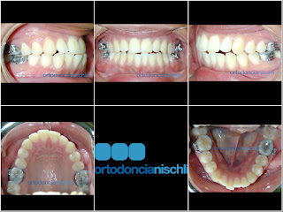 ORTODONCIA