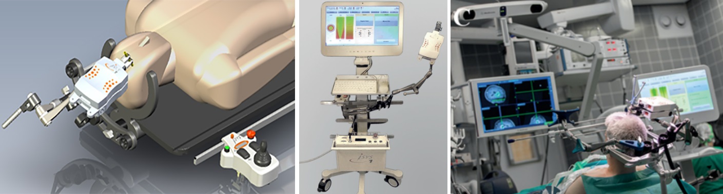 iSYS teams with Medtronic