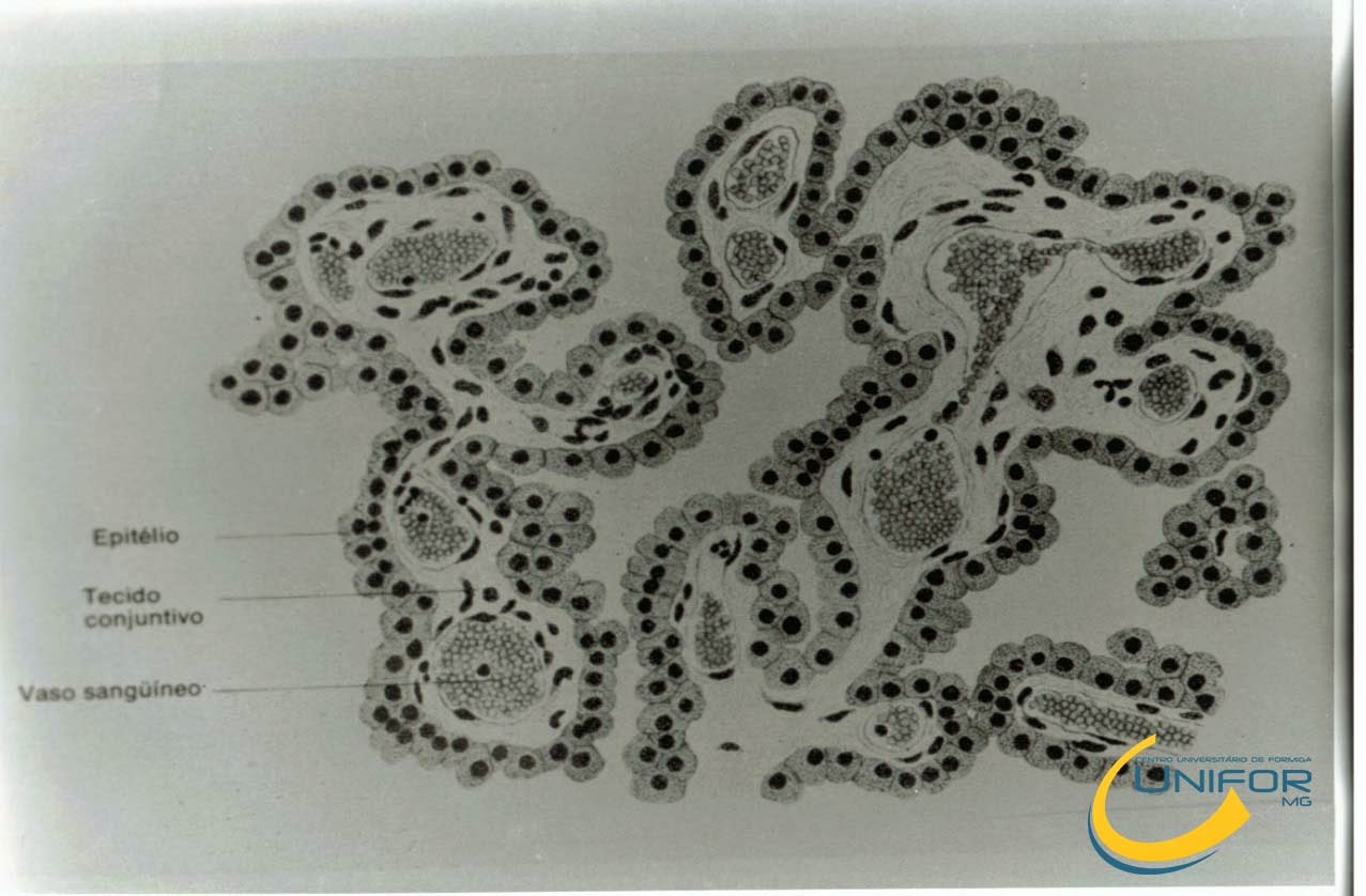 Atlas Histológico UNIFOR-MG: Plexo coroide