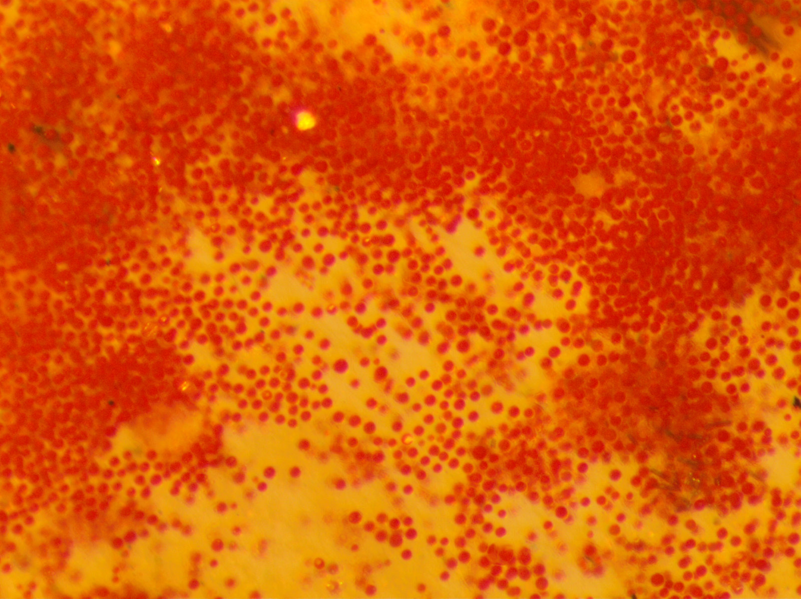 Freshwater & Marine Algae: Specimen #5: Haematococcus