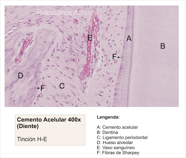 Riánsares' blog: Cemento acelular