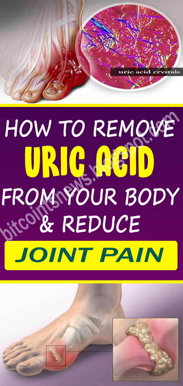 How To Quickly Remove Uric Acid Crystallization From Your Body To ...