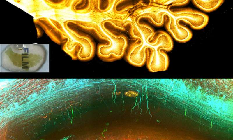 Our Parkinson's Place: New tissue technique gives stunning 3-D insights ...