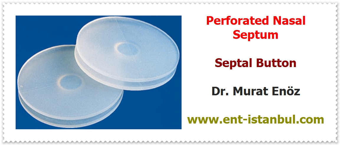 Nasal Septum Perforation - Definition, Causes, Symptoms, Diagnosis and ...