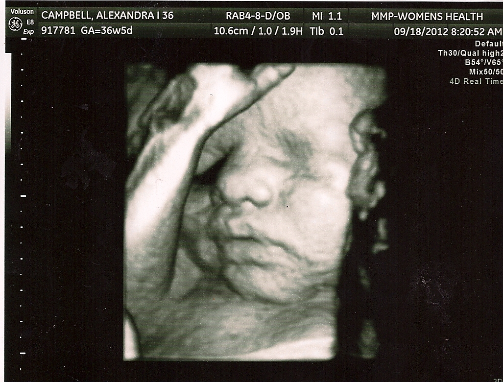 Us, Poppet, and the Little Boy Wonder: 39 weeks