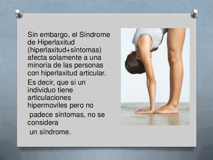 E.Bs.As: ¿Qué es la hiperlaxitud articular?