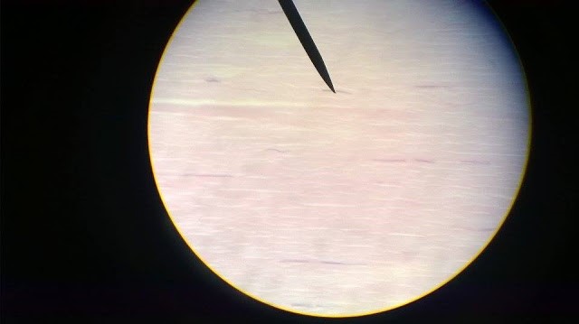 Histología: Tendón