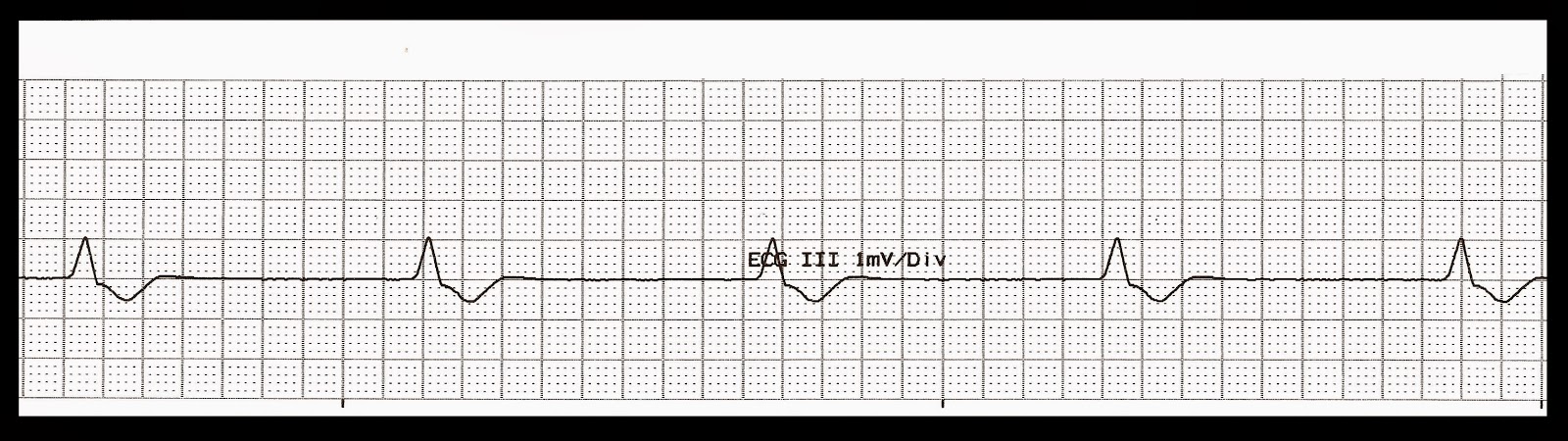 Practice EKG Strips 340
