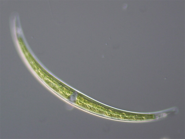 Microscope World Blog: Closterium under the Microscope