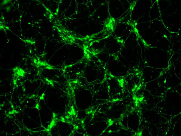 Neuromics: GFP Labeled Motor Neurons and MEA