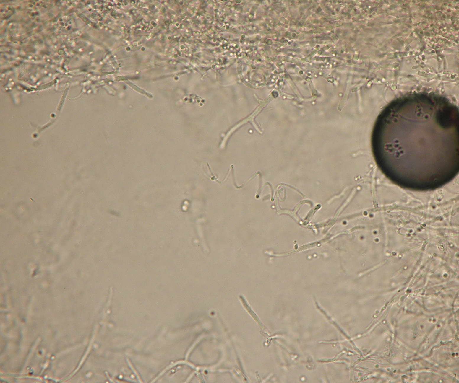 ATLAS MICOLOGIA: TRICHOPHYTON MENTAGROPHYTES