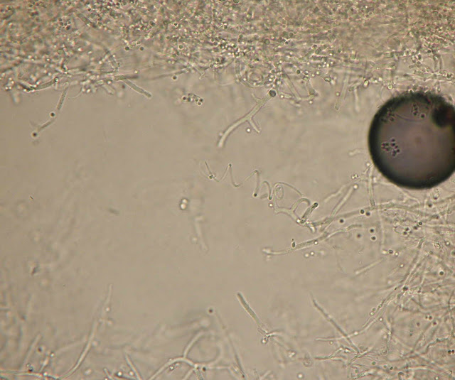 ATLAS MICOLOGIA: TRICHOPHYTON MENTAGROPHYTES