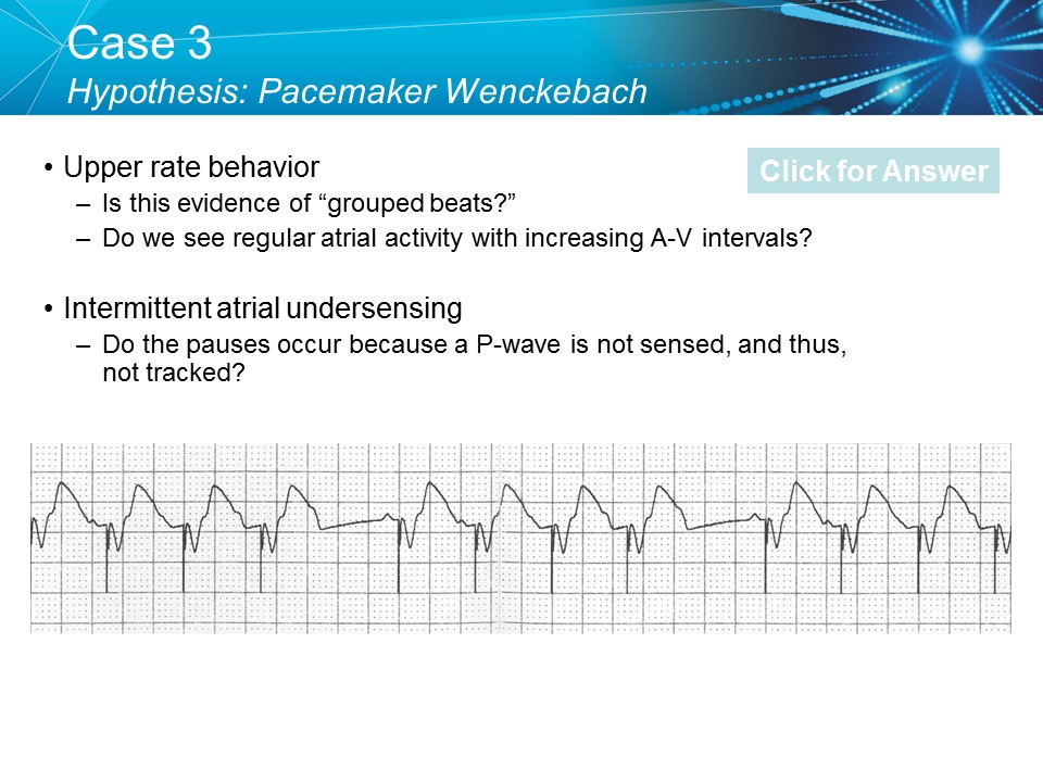 CVT Mohd Farid: Basic Pacemaker Troubleshooting Part I-Medtronic Academy