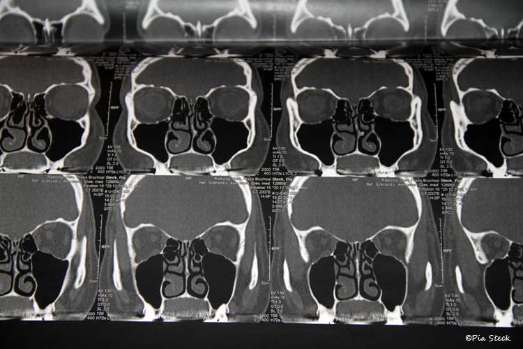 SichtBar: März 2012