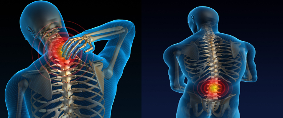 Mal di schiena: curarlo e prevenirlo