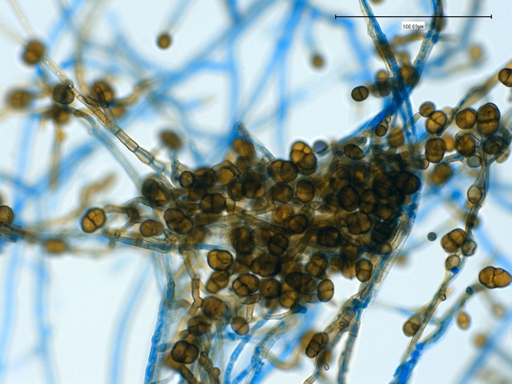 Fun With Microbiology (What's Buggin' You?): Stemphylium species