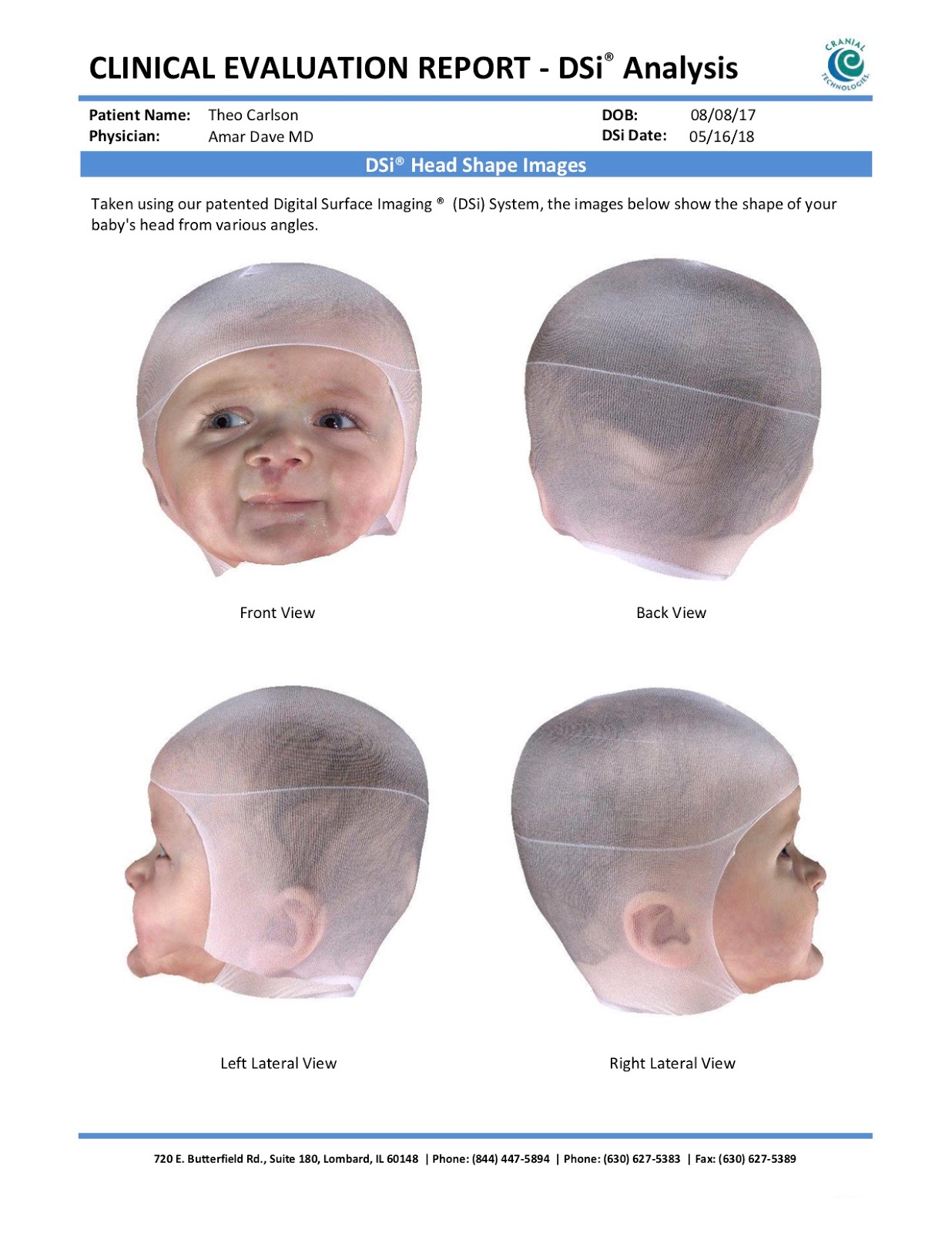 Here I am: Occupational Therapy Evaluation and Cranial Technologies