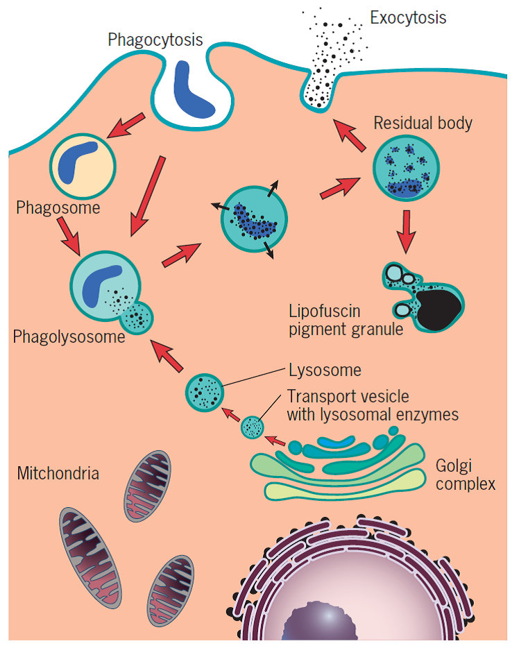 Patología B: FAGOCITOSIS