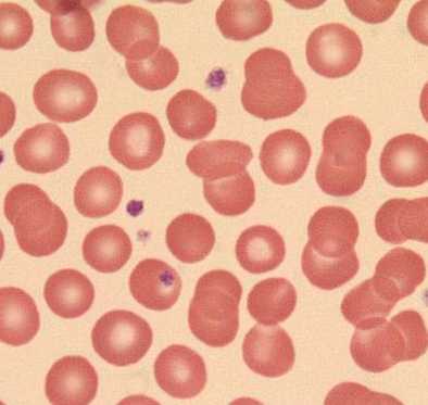 belajar tentang trombosit yuukk ^__^ | dewikusumastuti94