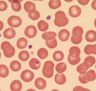 disease information: Nilai Normal Trombosit