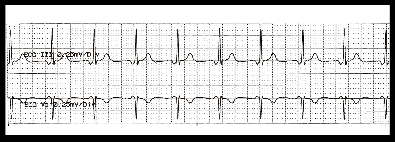 Practice EKG Strips 359
