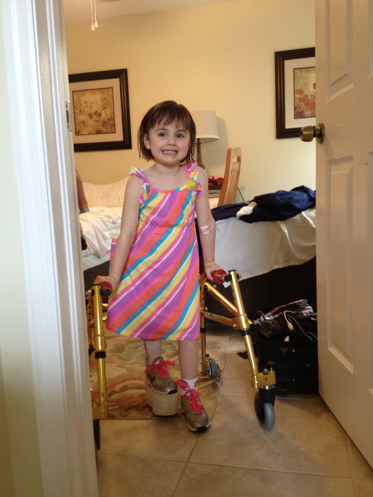 Madi's Milestones with PFFD: Ups and Downs