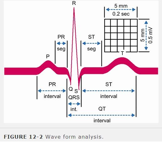 Nurses Guide to Nursing Practice: Electrocardiogram