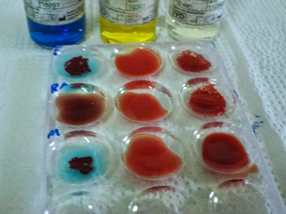 BIOLOGANDO: Grupos Sanguíneos - Sistema ABO e Fator Rh