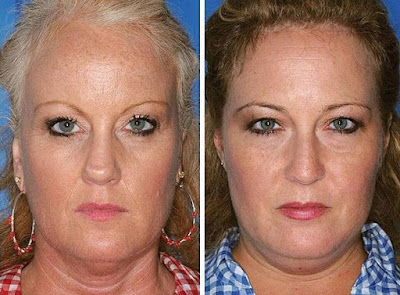 Fun And Entertainment: How Smoking Ages The Face Of Identical Twins