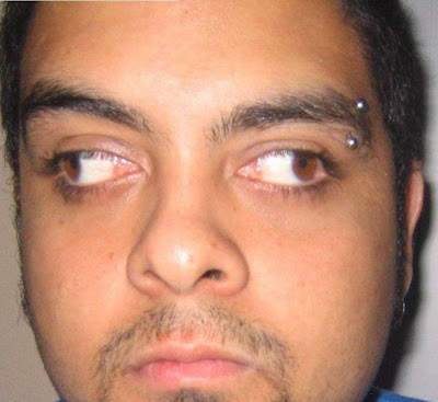 Funny Crossed Eyes | Funnilogy