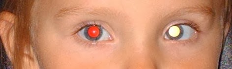 Crash Course in the Young Pediatric Examination - Eyedolatry