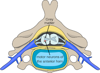 Spinal Muscular Atrophy ,SMA izomsorvadás,: Novartis SMA