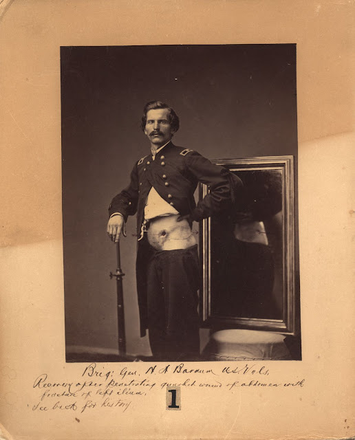 Eerie Vintage Portraits of Wounded Soldiers During the American Civil ...