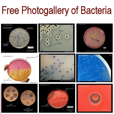 Medical Laboratory and Biomedical Science: Free online gallery of bacteria