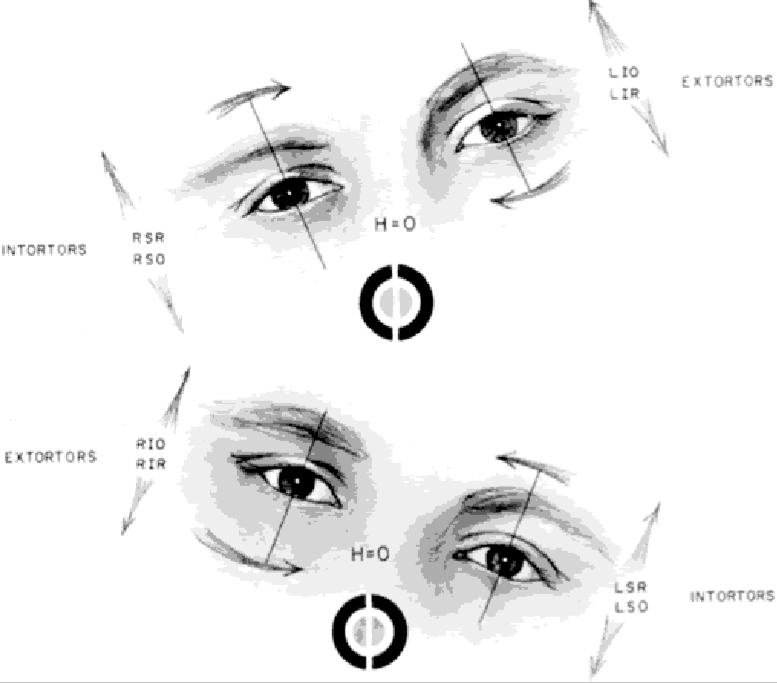Cátedra N° 21 - Seminario N° 11 "Test de Parks"