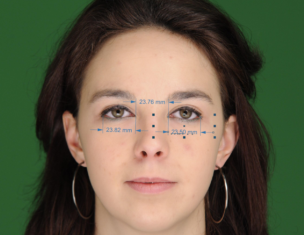 Creating a Database for Wide-Close-Normal Eyes
