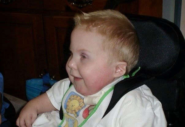 Faith Warrior: CHARGE Syndrome