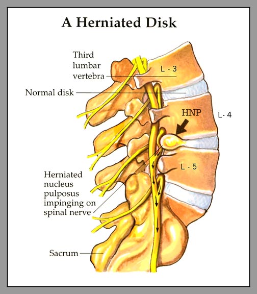 NURSING SCIENCE : HNP, Apa sih?