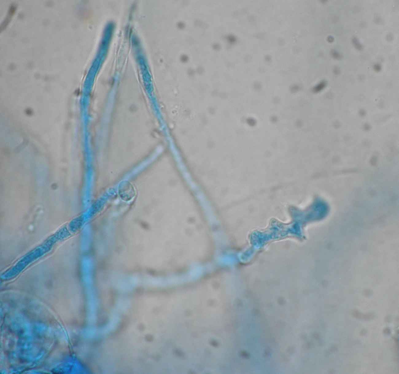 ATLAS MICOLOGIA: MICROSPORUM AUDOUINII