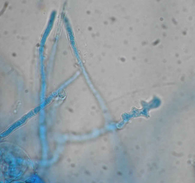 ATLAS MICOLOGIA: MICROSPORUM AUDOUINII