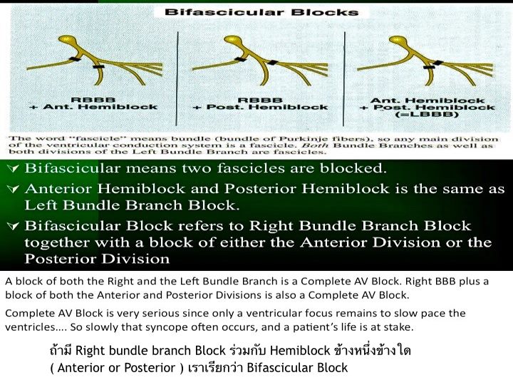 complete block และ incomplete block