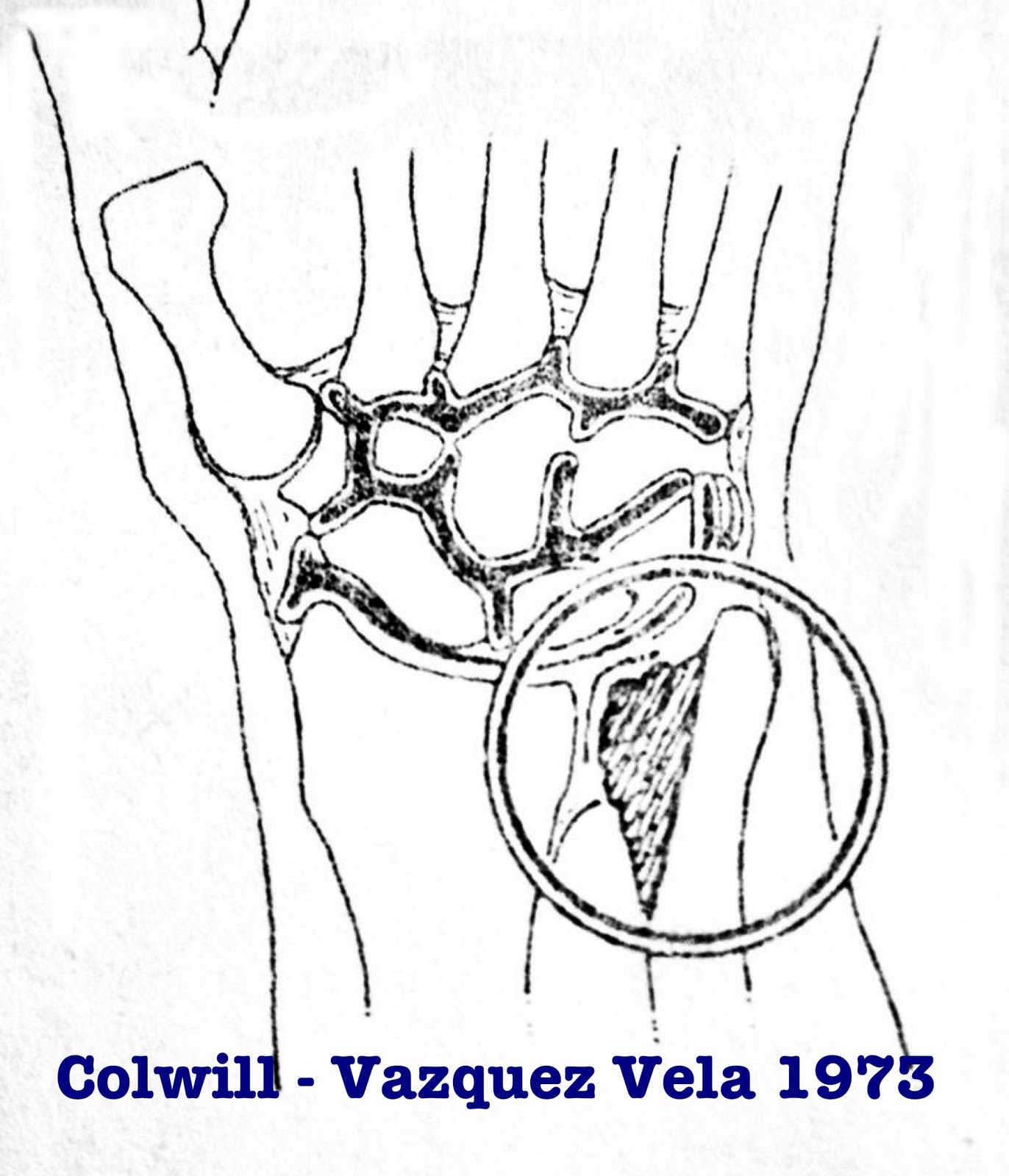 OSSA CARPALIA ©: noviembre 2011