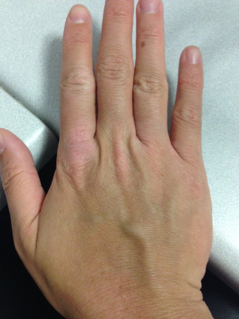 My journey to healthy skin: VIRAL: My skin caught a cold, then gave it ...