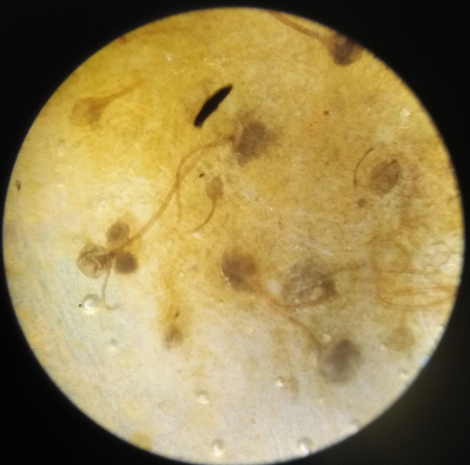 Struktur Jamur Oncom - Perumperindo.co.id