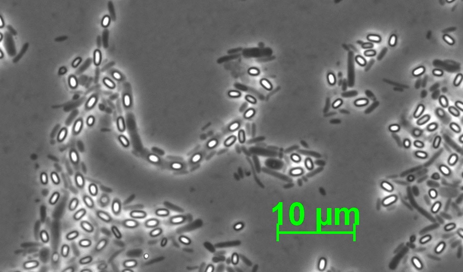 Of Bacteria and Men: Filamentous bacteria under the microscope
