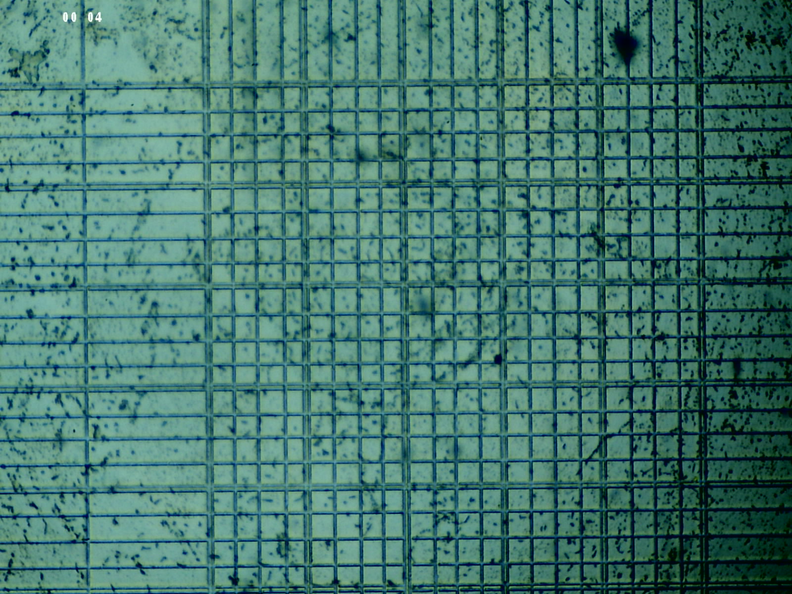 Using a haemocytometer | The Madhaus