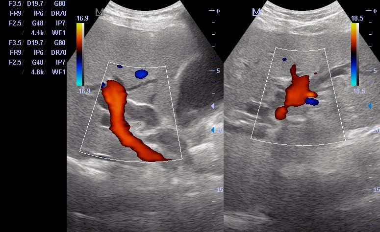 VIETNAMESE MEDIC ULTRASOUND: June 2014